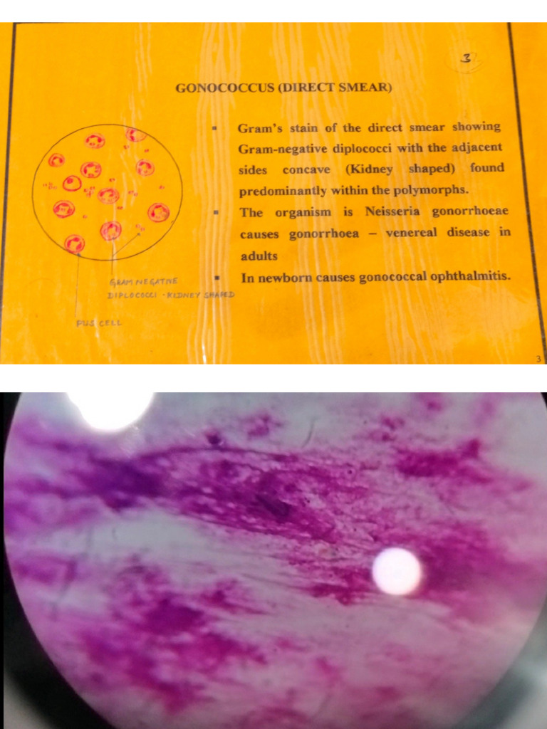 Micro Spotters 2024 | PDF