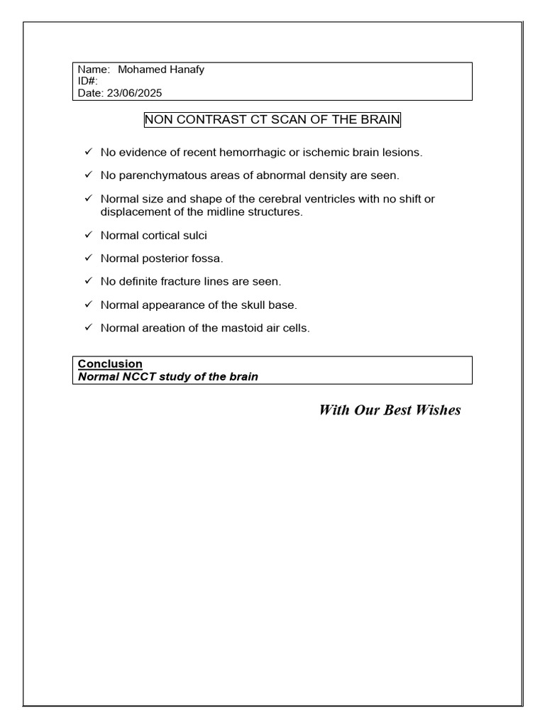 Mohamed Hanafy Brain | PDF