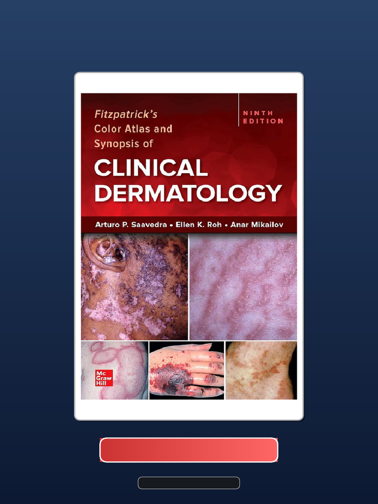 Get Test Bank For Fitzpatricks Color Atls and Synopss of Clinical ...