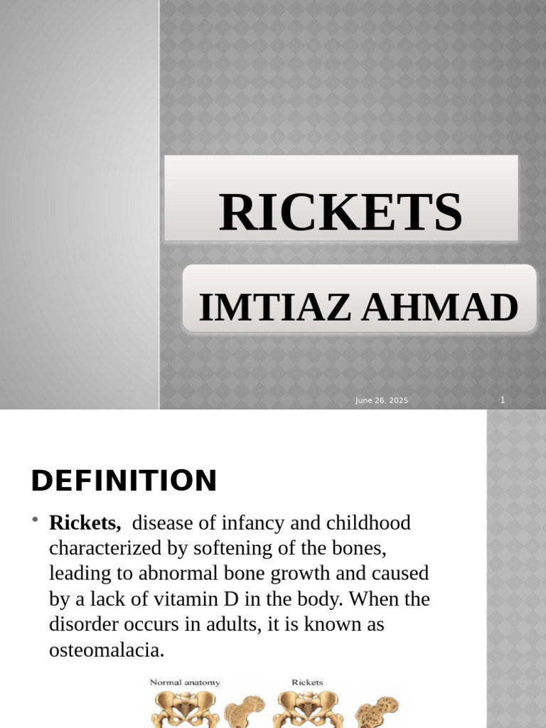 Rickets and Osteomalcia | PDF | Vitamin D | Vitamin