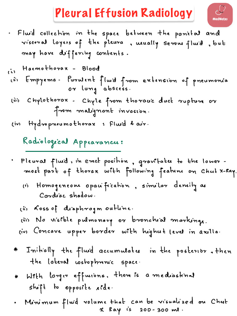 Pleural Effusion Radiology Guide | PDF | Lung | Respiratory System