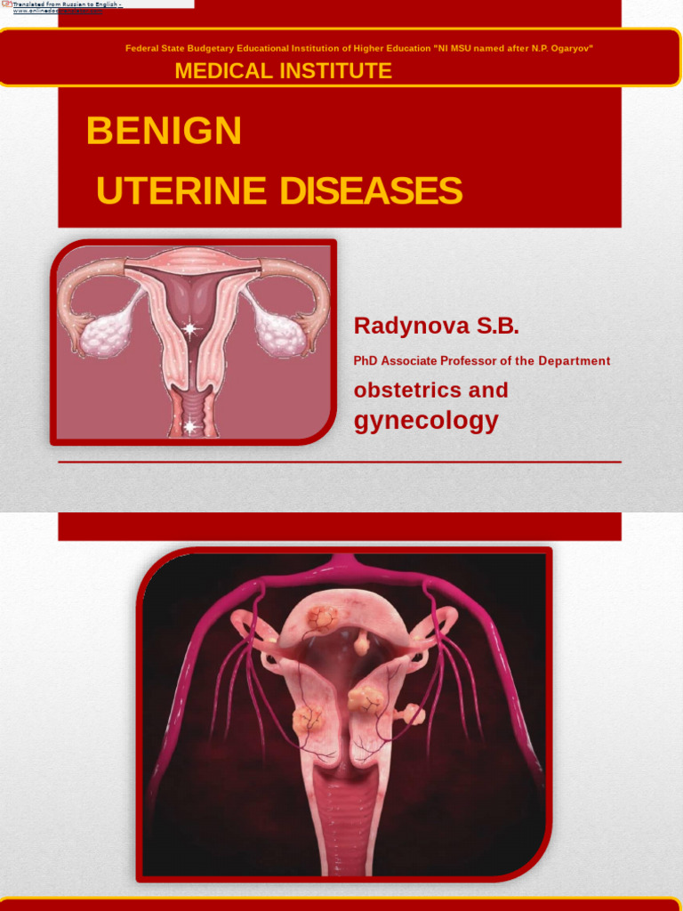 Polyp Fibroids of Uterus | PDF | Menstrual Cycle | Uterus