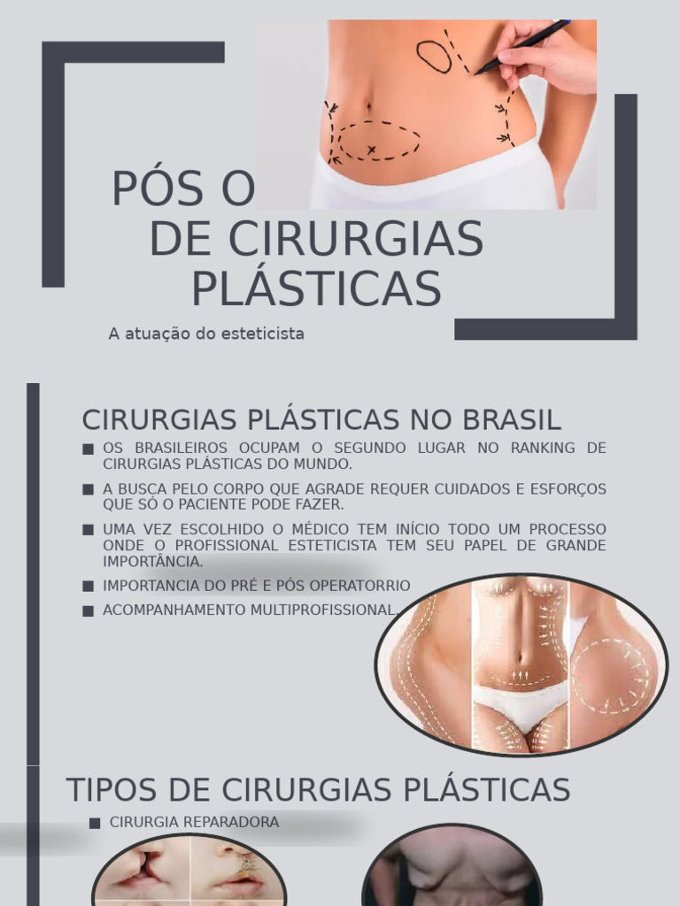 Pós Operatorio Harmonic | PDF | Sistema linfático | Seio