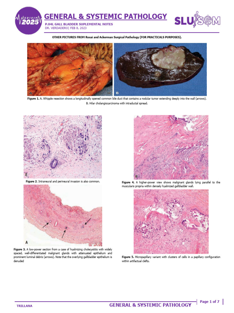 (GSP L) P.03 Gall Bladder Supplemental Notes | PDF | Gallbladder ...