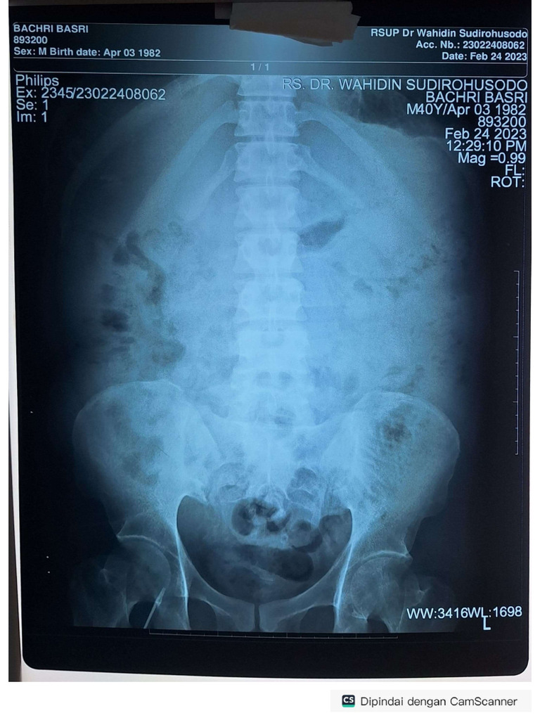 Radiologi CSL Geh | PDF