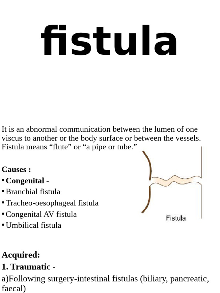 Understanding Fistulas and Treatments | PDF