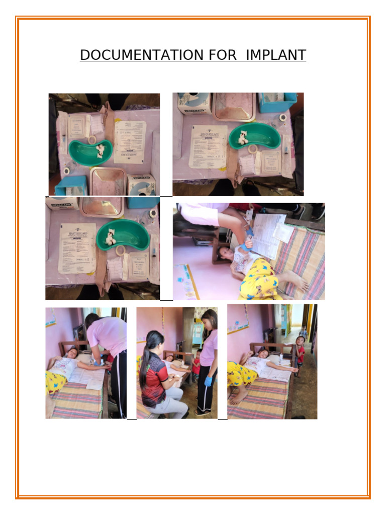 Documentation For Implant | PDF