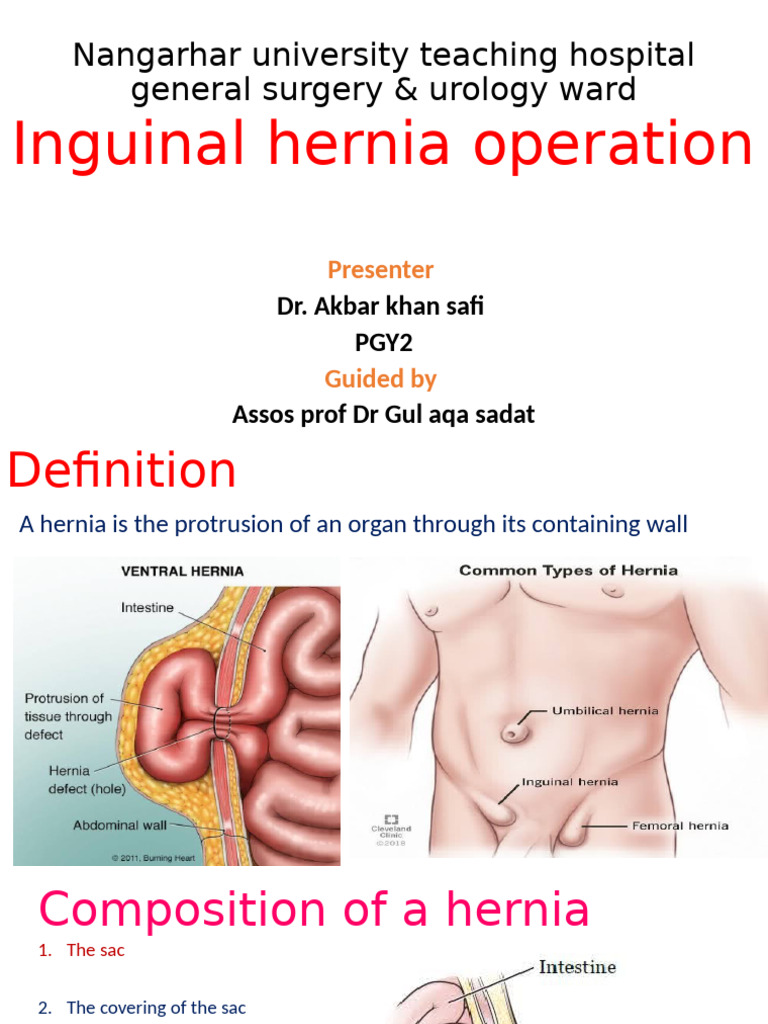 Inguinal Hernia Operation - Second Year | PDF