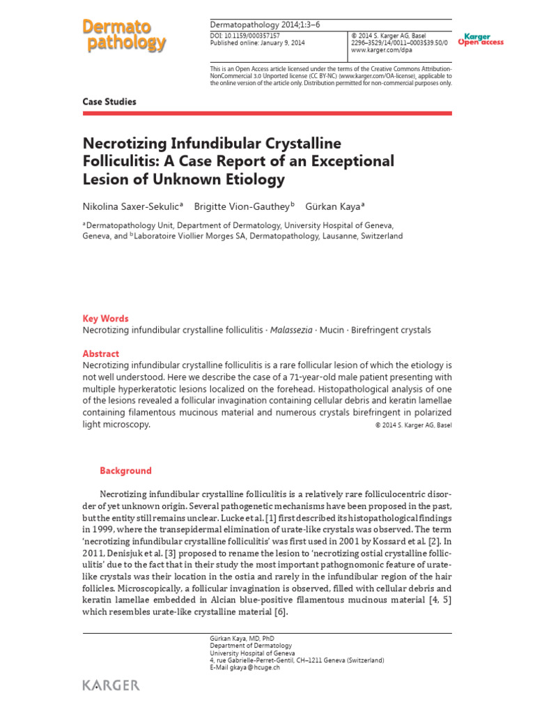 Necrotizing Infundibular Crystalline Folliculitis | PDF | Histology ...