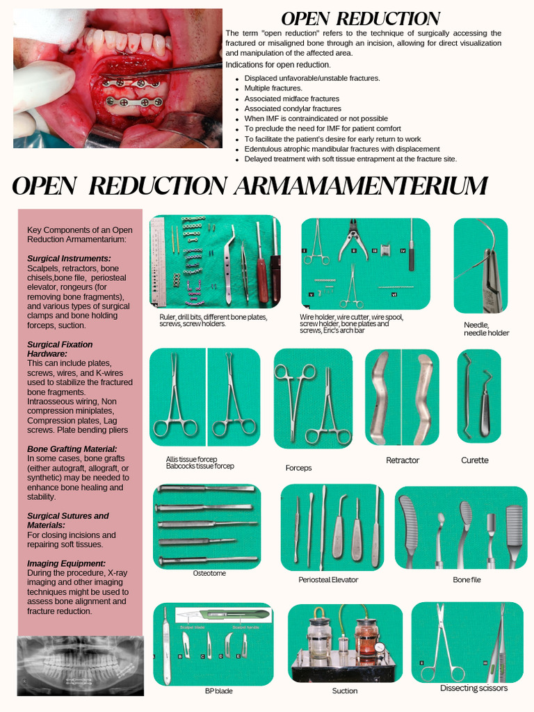 Open Reduction - 20250628 - 020146 - 0000 | PDF | Surgery | Bone