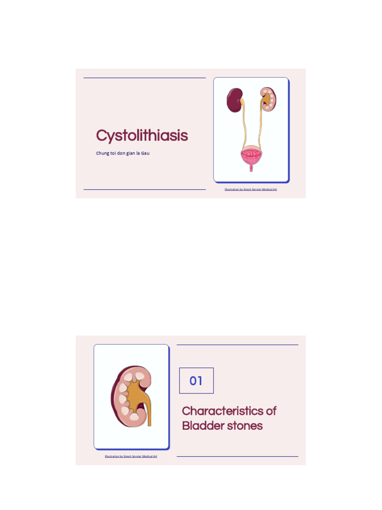 Cystolithiasis: Chung Toi Don Gian La Gau | PDF