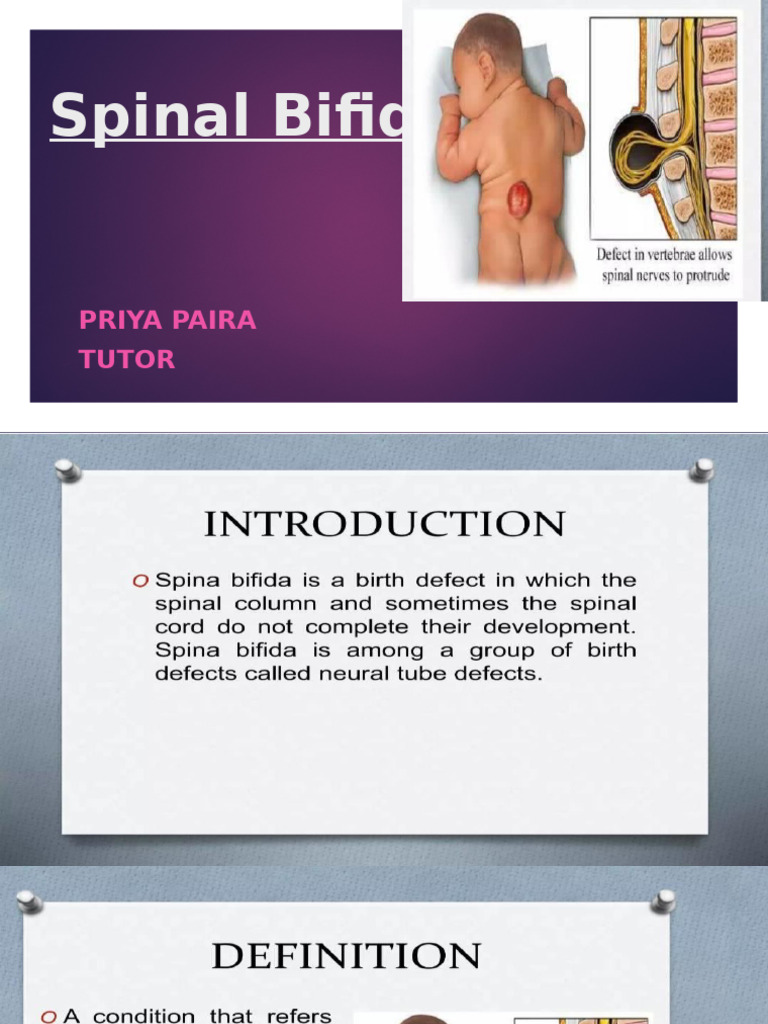 Spinal Bifida | PDF