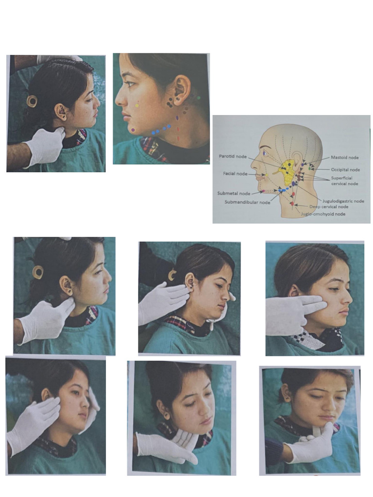Examination of Cervical Lymph Nodes | PDF