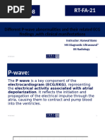 P Pulmonale Vs P Mitrale - Google Search | PDF