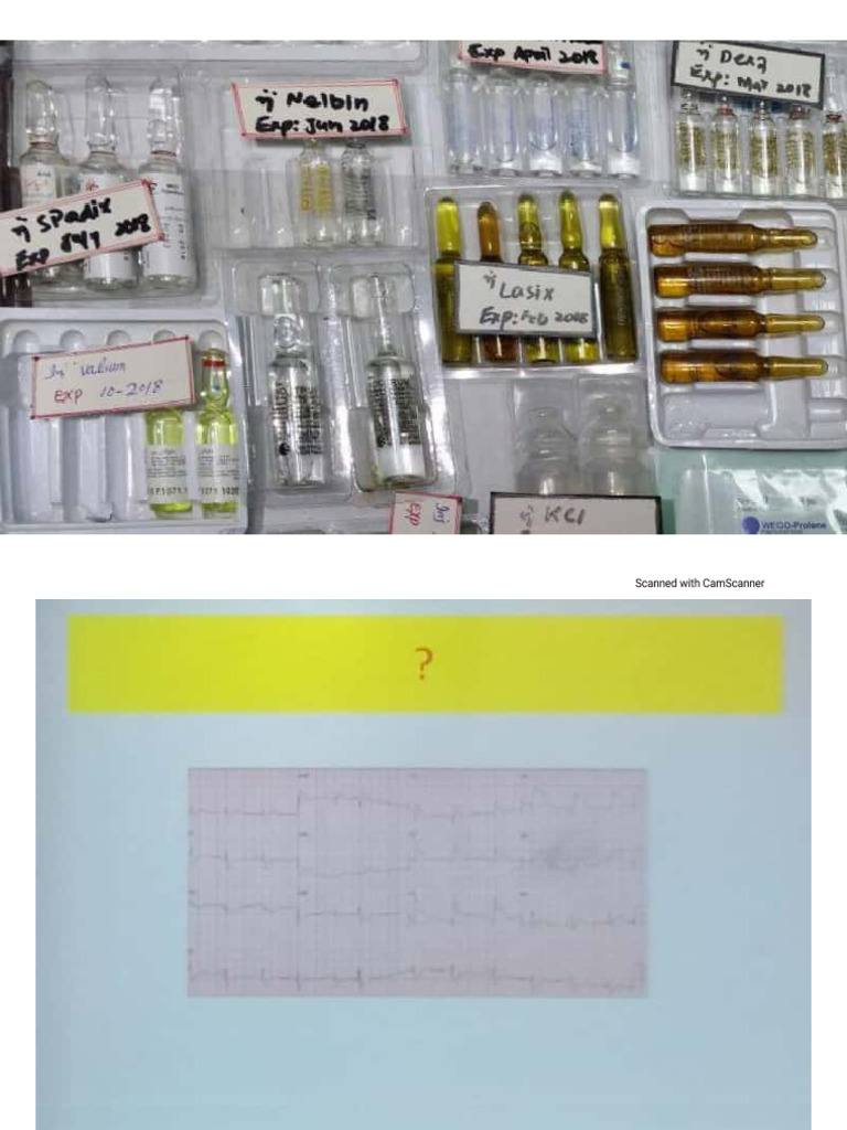 Drug Ecg | PDF