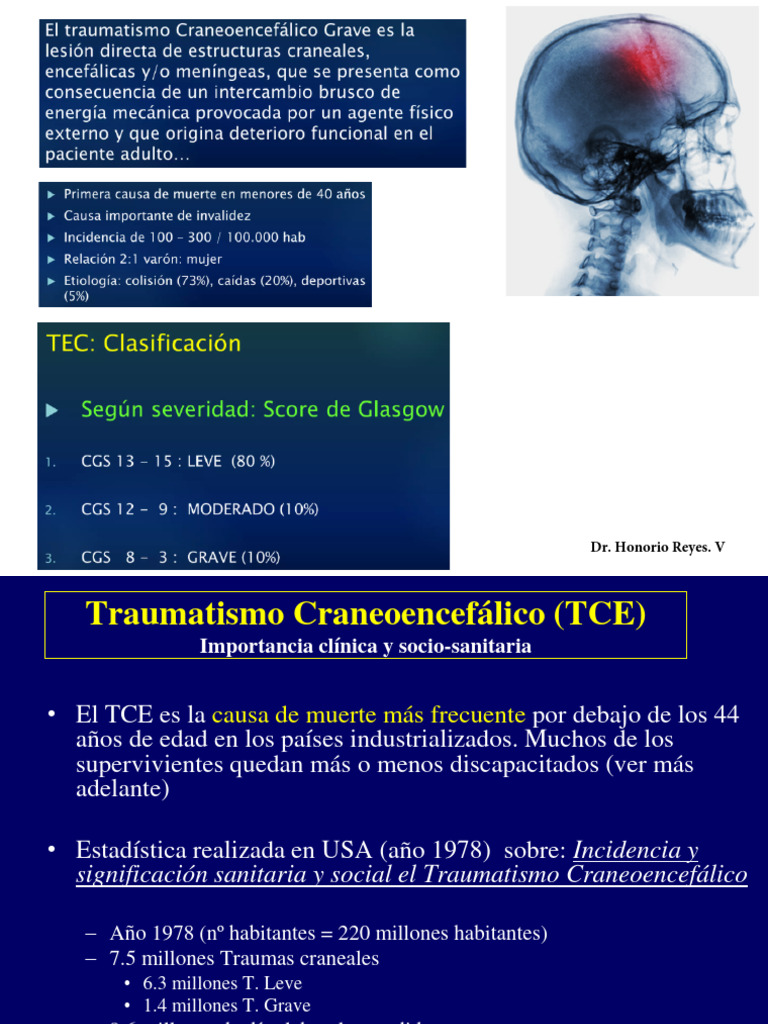 Traumatismo Craneoencefálico: Impacto y Clasificación | PDF | Lesión ...
