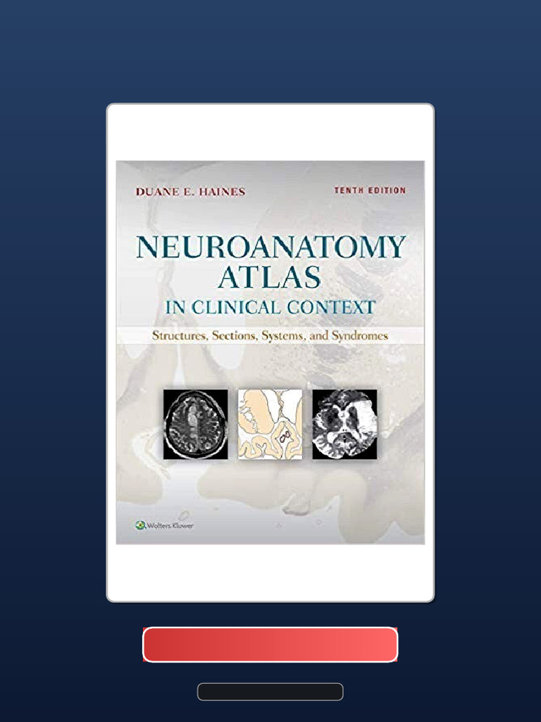 Neuroanatomy Atlas in Clinical Context Structures Sections Systems and ...