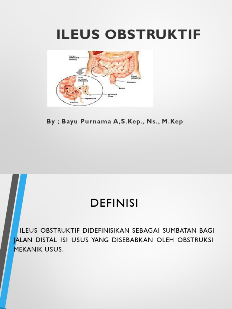 Ileus Dan Kolelitiasis | PDF