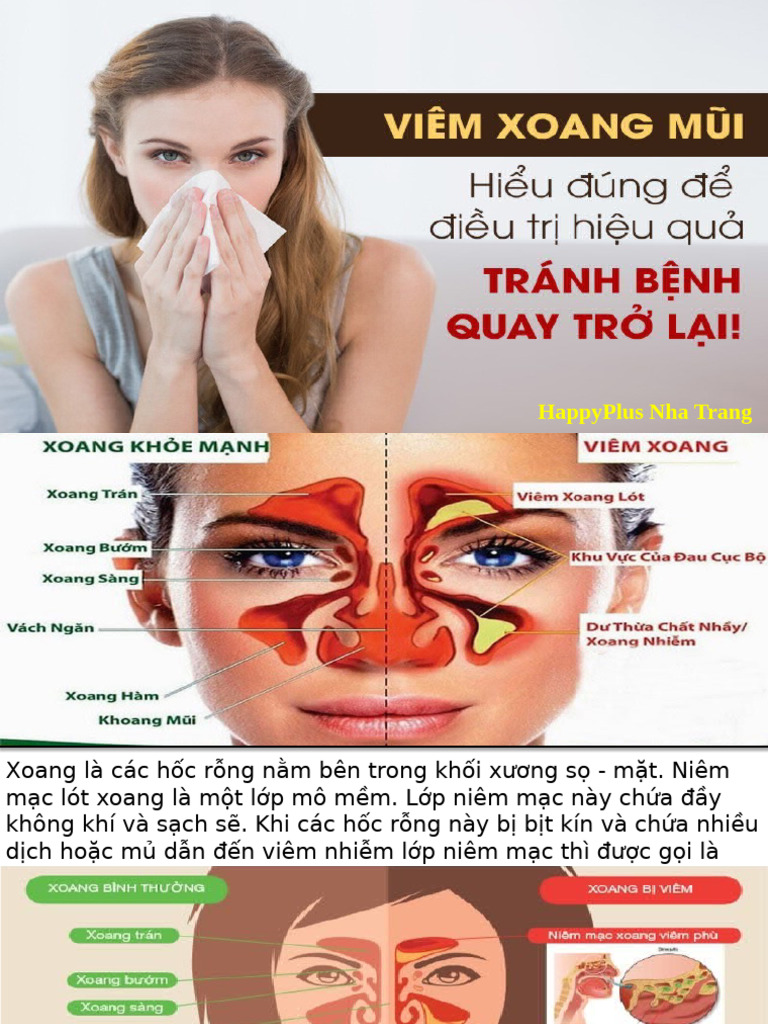 TTN & BỆNH VIÊM XOANG | PDF