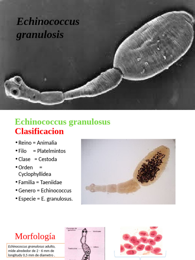 Echinococcus granulosus: Patogenia y Diagnóstico | PDF | Animales y ...