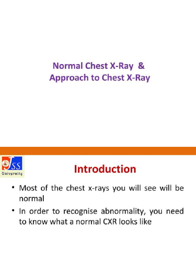 Chest Xray | PDF