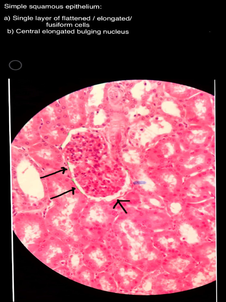 Simple Epithelium | PDF