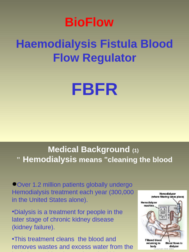 Hemodialysis Fistulas - Sri (Amnon) | PDF | Hemodialysis | Vein