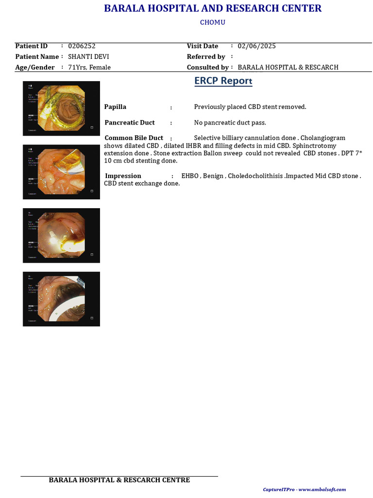 Shanti Ercp | PDF