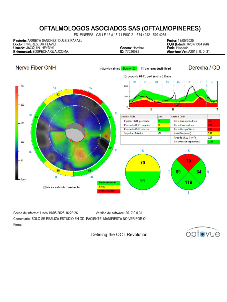 Oct Nervio - Paquimetria - Arrieta Sanchez Duleis Rafael | PDF | Glaucoma