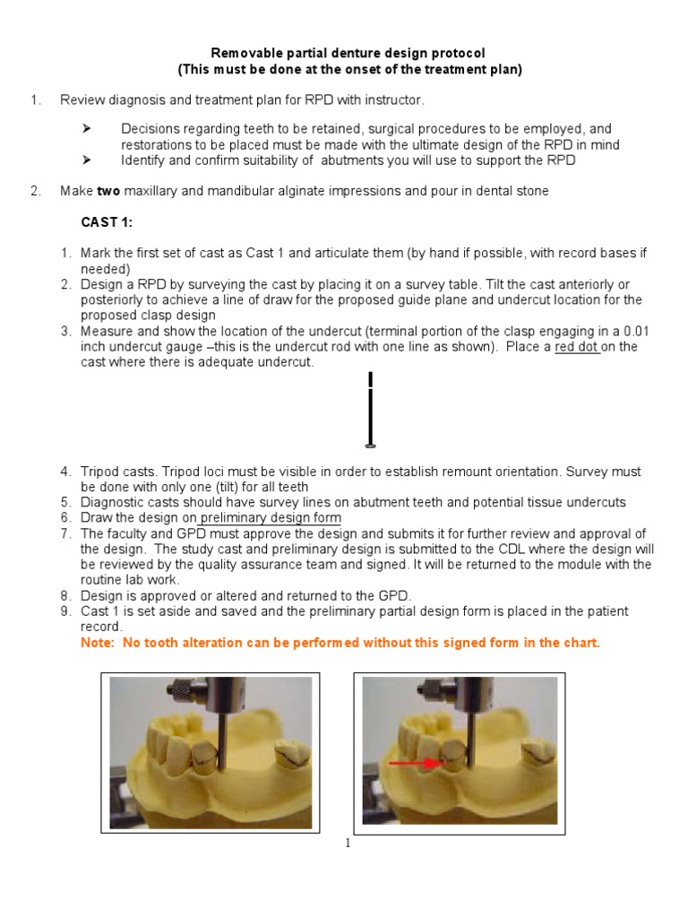 RPD Step by Step Protocol | PDF | Dentures | Health Sciences