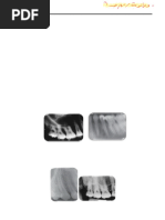 Common Errors in Dental Radiography | PDF