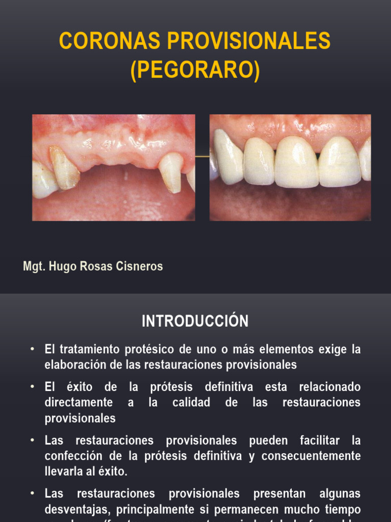 Importancia de las Coronas Provisionales | PDF | Odontología | Ramas de ...