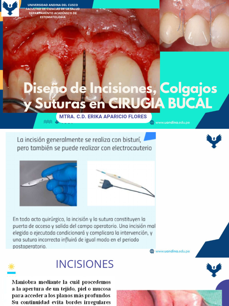 Diseño de Incisiones, Colgajos y Suturas | PDF