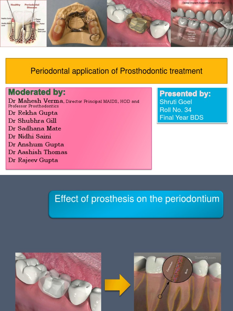 PAPT | Human Tooth | Dental Implant