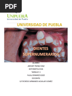 Dientes Supernumerarios: Diagnóstico y Extracción | PDF | Diente ...