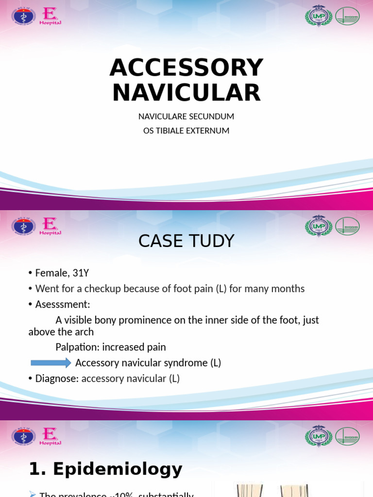 Accessory Navicular Syndrome Overview | PDF | Foot | Musculoskeletal System
