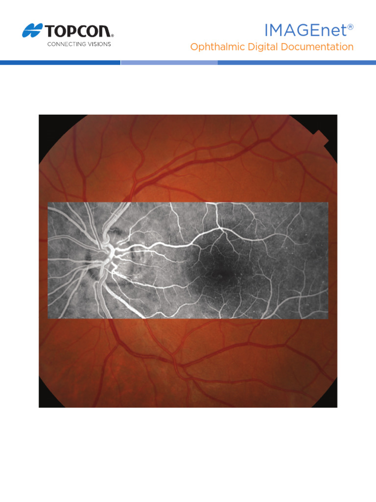 IMAGEnet Brochure - English-1 | PDF | Windows Xp | Microsoft Windows