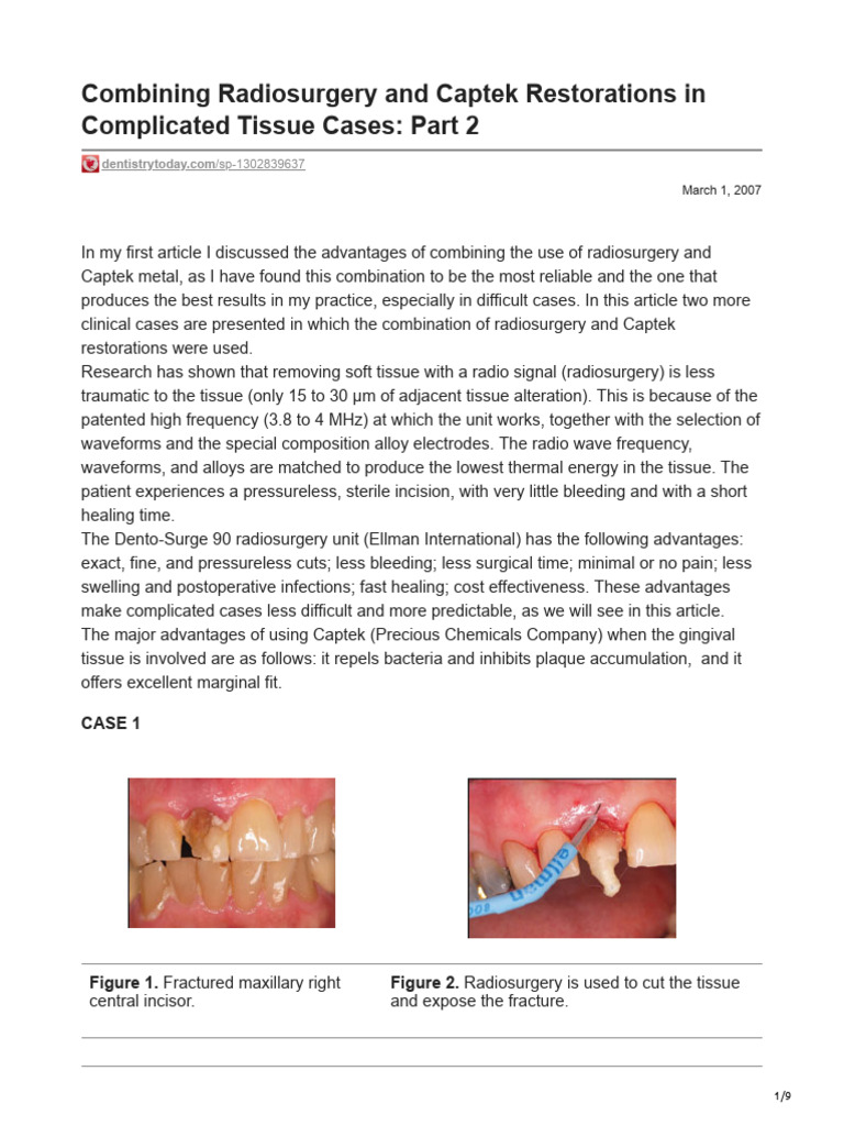 Combining Radiosurgery and Captek Restorations in Complicated Tissue ...