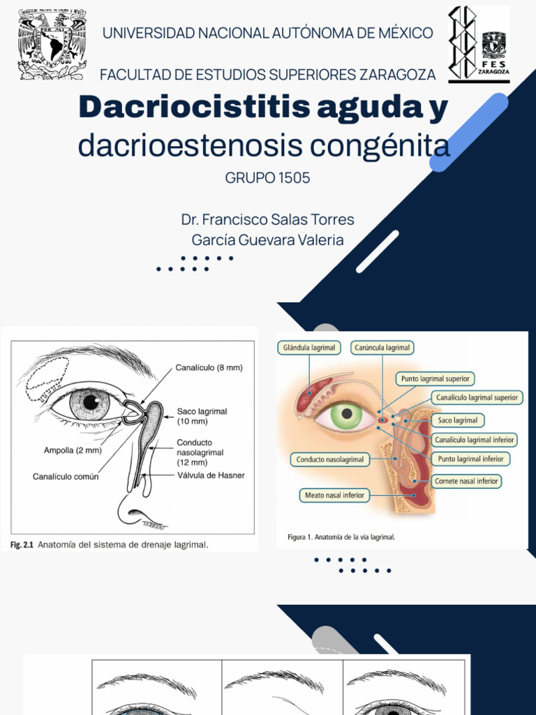 dacriocistitis-y-dacrioestenosis-en-ni-os-pdf-diagnostico-medico