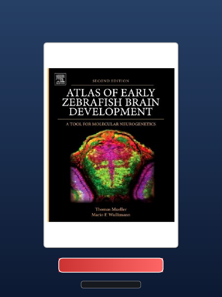 Atlas of Early Zebrafish Brain Development a Tool for Molecular ...