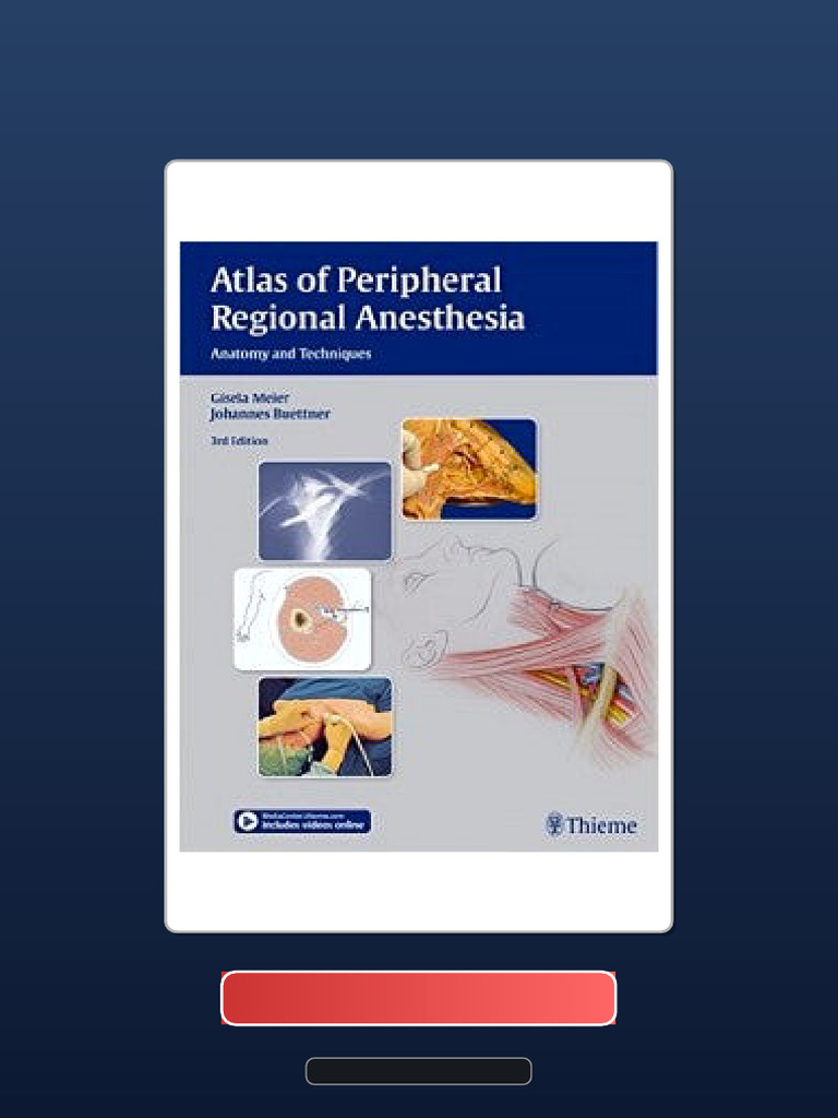 Atlas of Peripheral Regional Anesthesia Anatomy and Techniques 3rd Edition Full Download | PDF ...