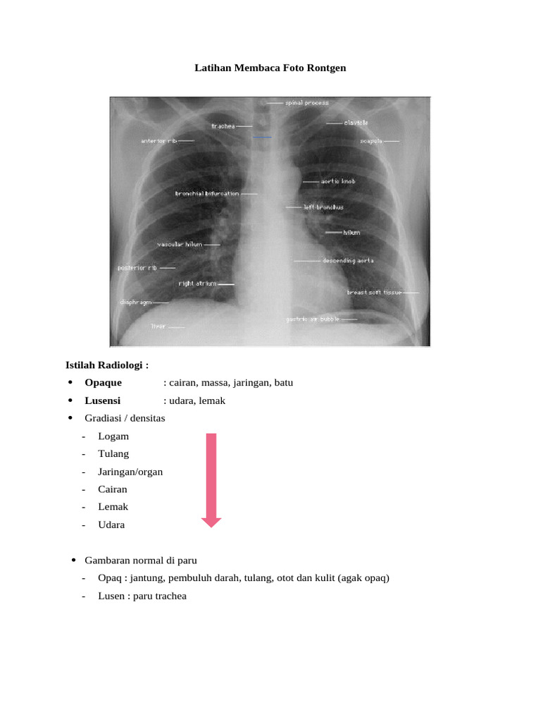 Latihan Membaca Foto Rontgen | PDF