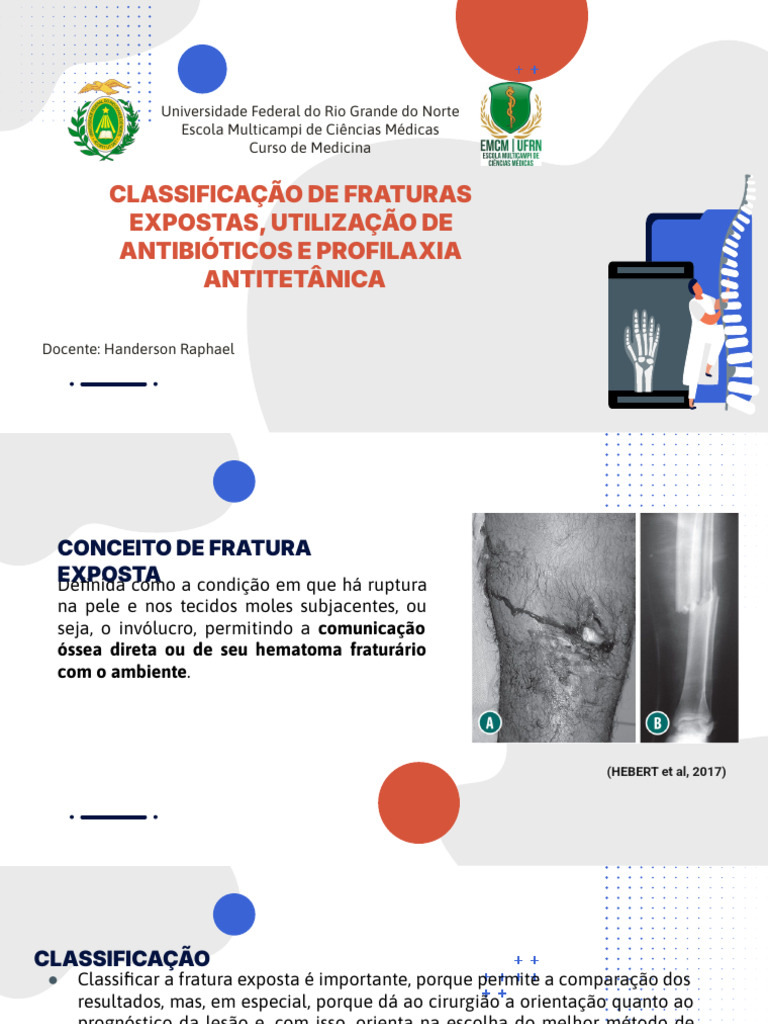 Fraturas Expostas - Optativa de Traumatologia | PDF | Especialidades ...