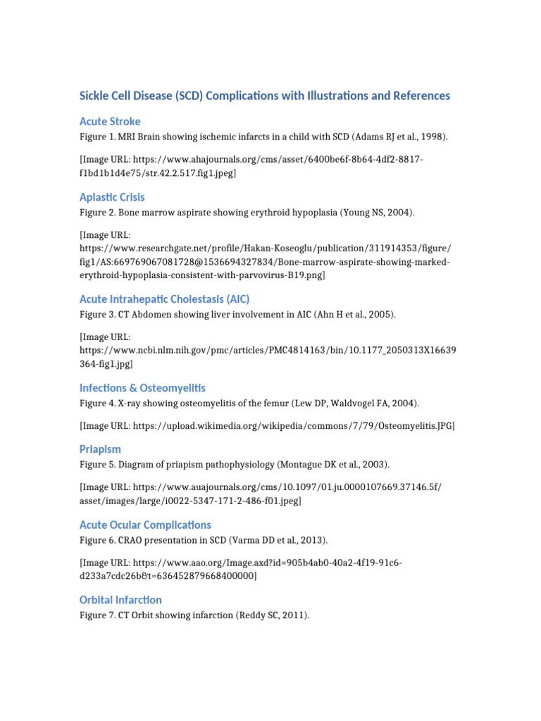 Sickle Cell Disease Complications Guide | PDF | Angiology ...