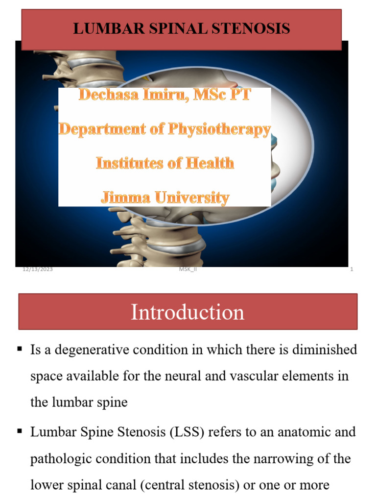 Lumbar Spinal Stenosis Overview | PDF | Vertebral Column | Diseases And ...