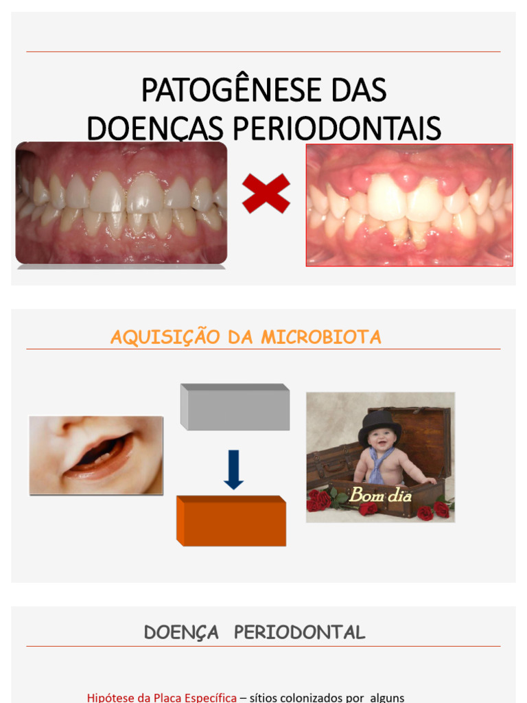 Patogênese das Doenças Periodontais | PDF | Sistema imunológico ...