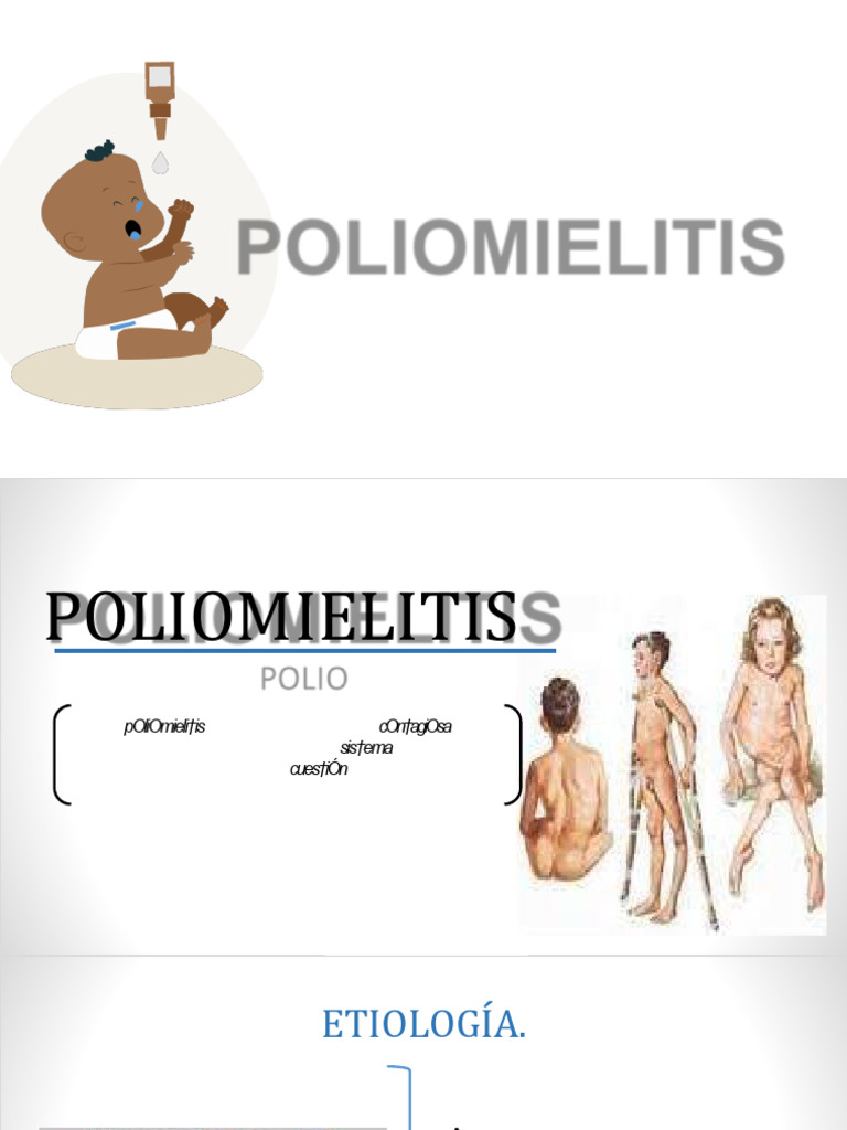 Información sobre Poliomielitis y su Tratamiento | PDF | Enfermedades y ...