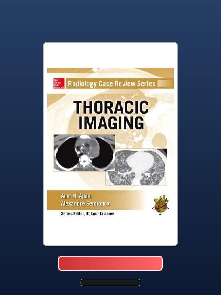 Complete Bundle Radiology Case Review Series Thoracic Imaging Ebook and ...