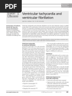 Monomorphic Ventricular Tachycardia ECG | PDF | Electrocardiography ...
