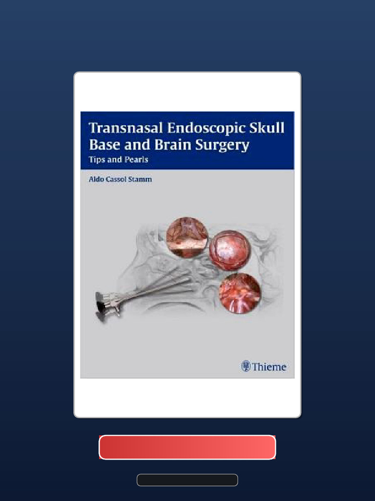 Complete Bundle Transnasal Endoscopic Skull Base and Brain Surgery Tips and Pearls Ebook and ...